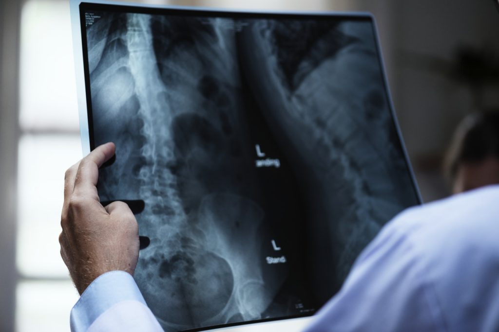 Treating Spinal Cord Injuries with the Help of Technology - TechStory